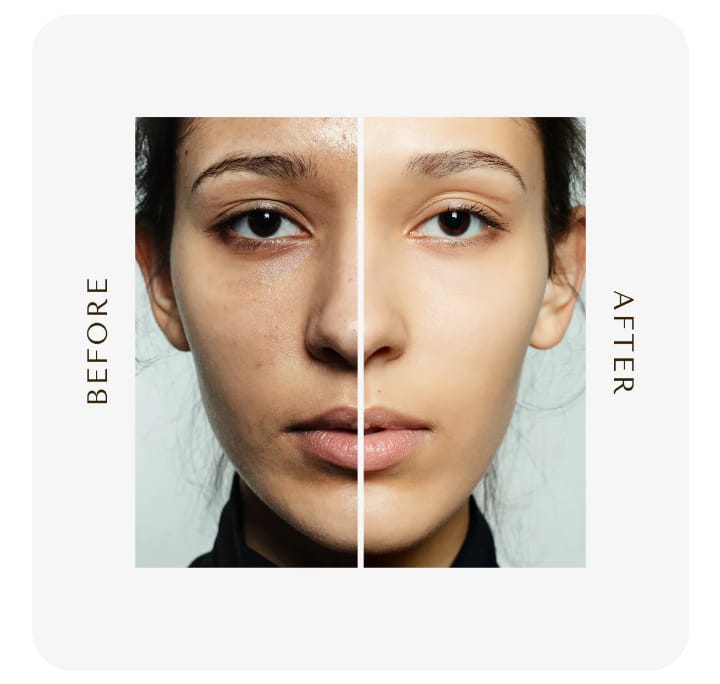 Glow Natural Glutathione Alpha Arbutin Skin Brightening Cream | Daraz.pk